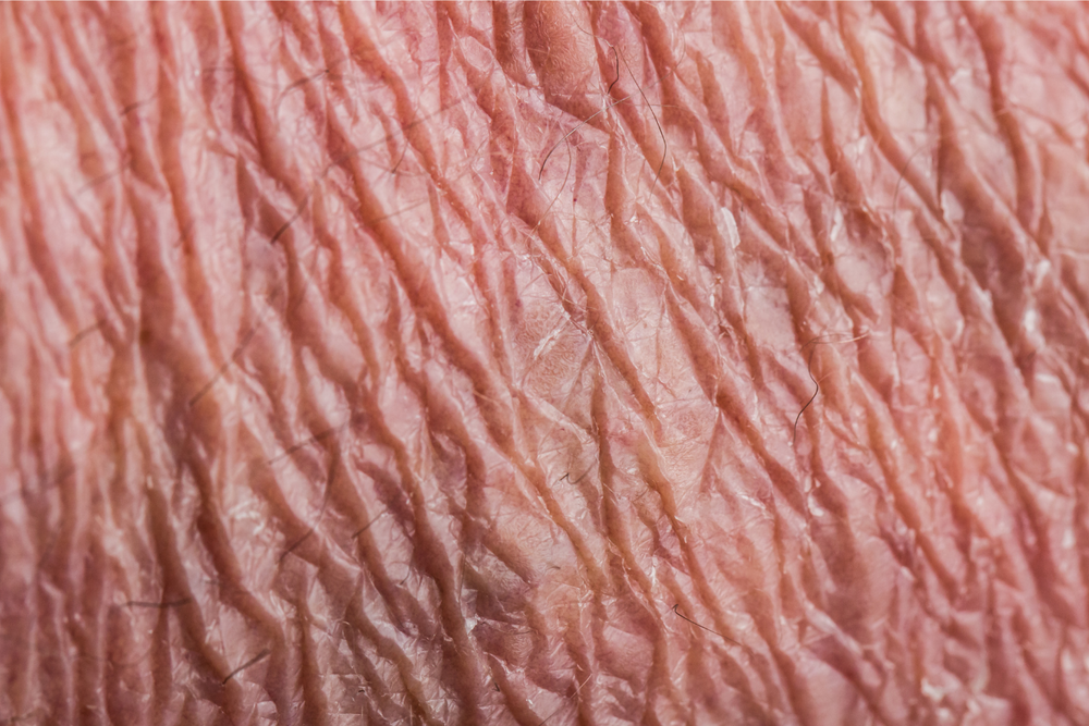 What is the Best Lotion for Crepey Skin On Arms and Legs? - Greenway ...
